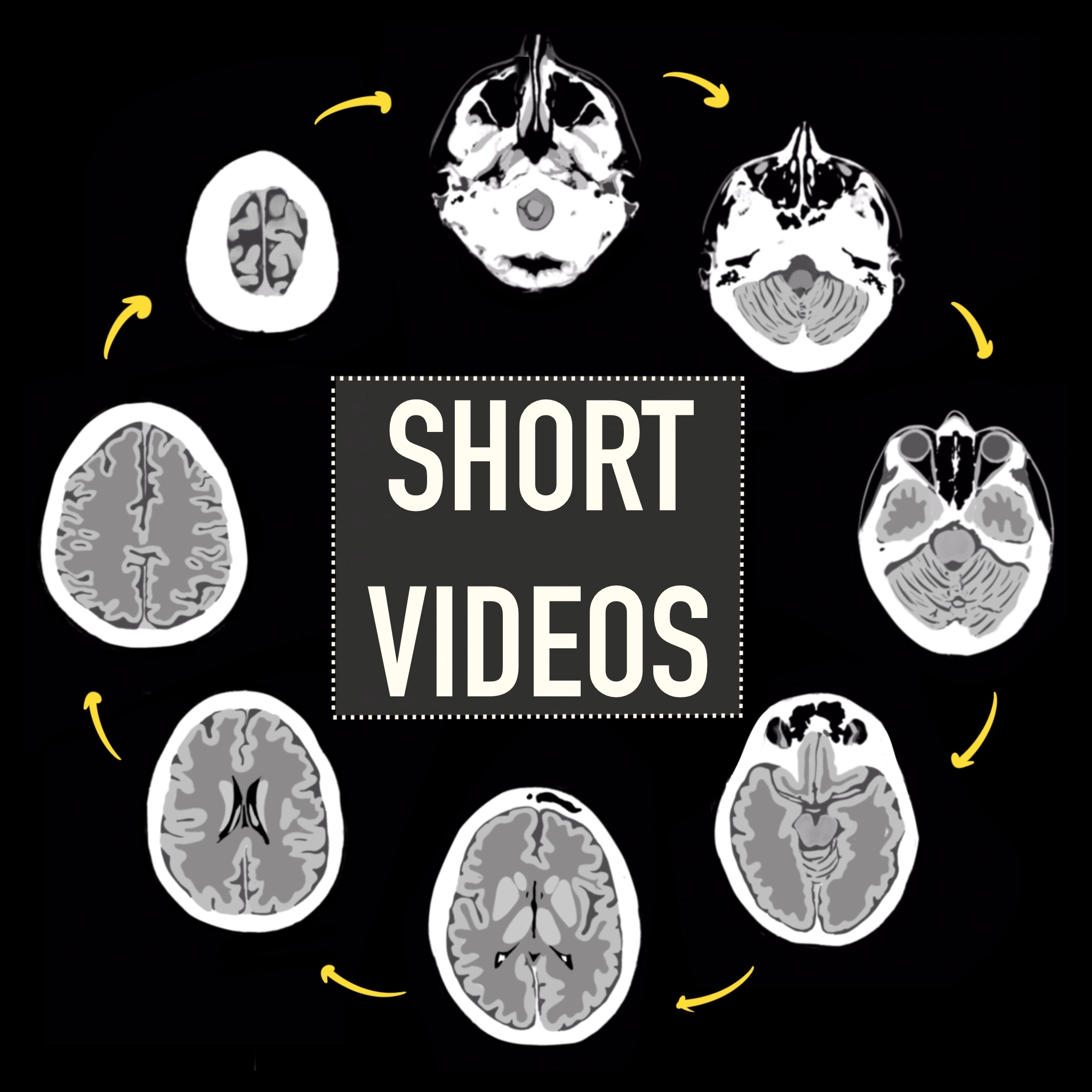Radiology Illustration
